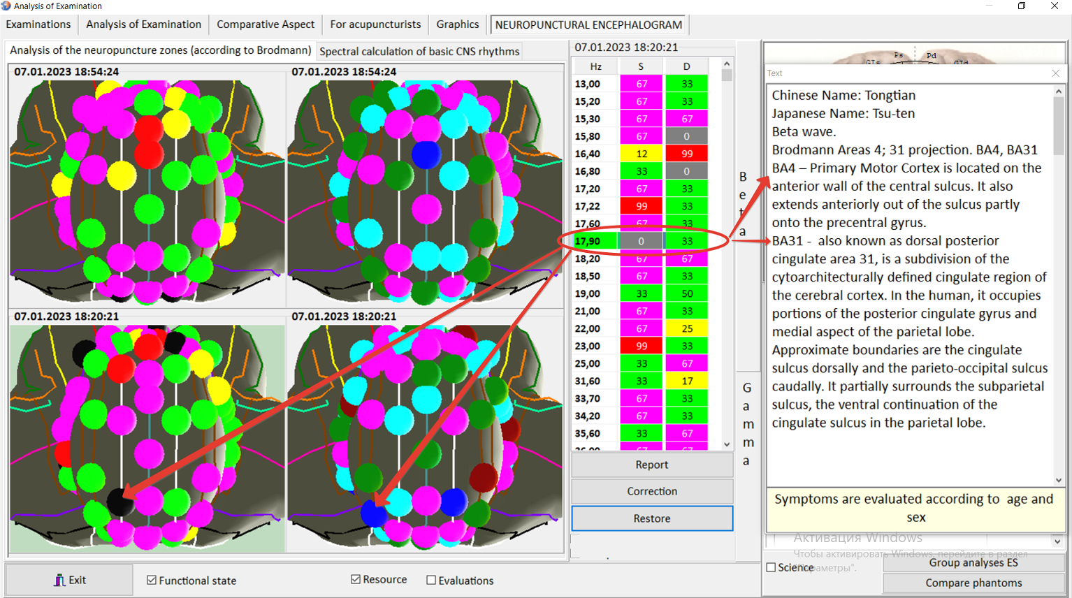 The ROFES\MONICOR set - the professional technology in medicine and ...